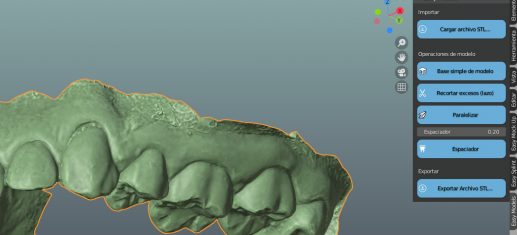Easy Dental CAD – Open Source meets dentistry!